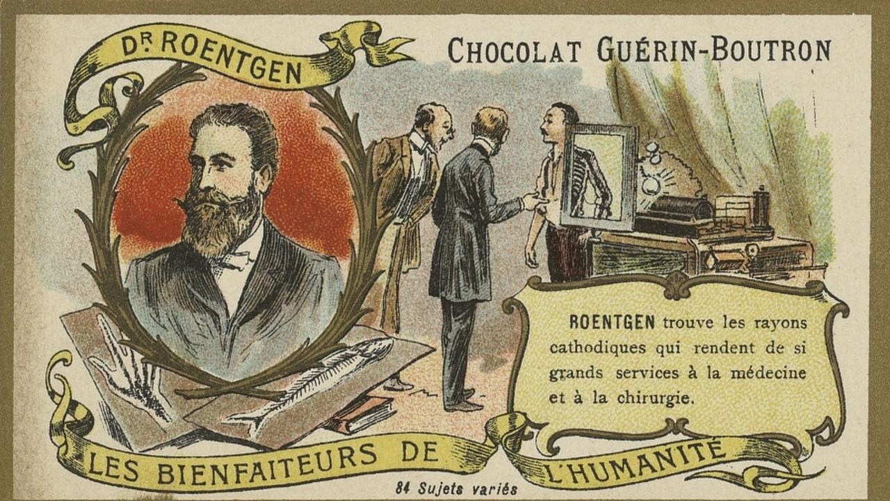 8 November 1895: Wilhelm Roentgen Menemukan X-Ray