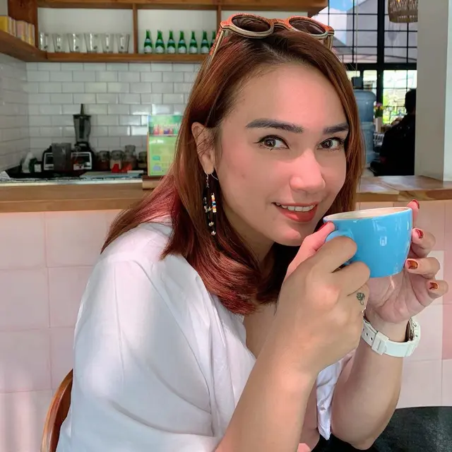 Kondisi Terkini Feby Febiola Setelah Jalani Kemoterapi - ShowBiz ...