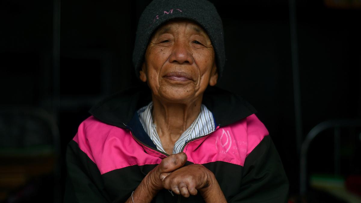 4 Penyebab Penyakit Kusta, Gejala, Jenis serta Cara Pengobatan yang ...