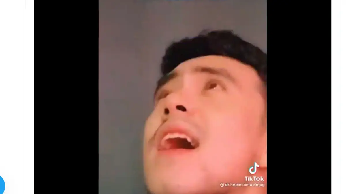 Berita dokter kevin tiktok Hari Ini - Kabar Terbaru Terkini | Liputan6.com