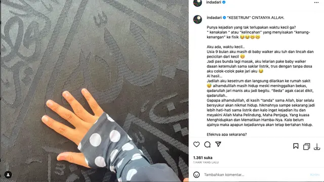 Memetik Hikmah dari Insiden Fatal yang Dialami Indadari Saat Kecil ...