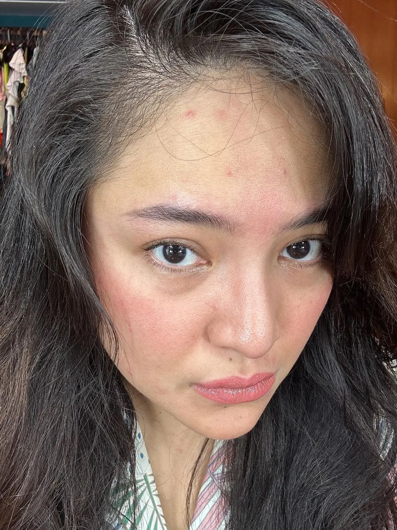 Pede Pamer Wajah Beruntusan, Marshanda Malah Kena Rayuan Maut Vicky ...
