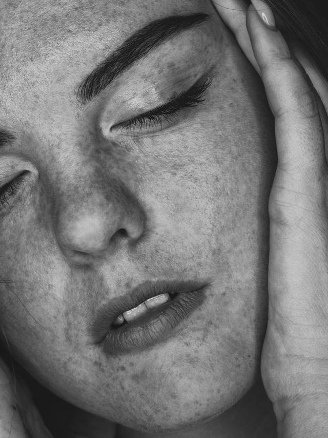 Dari Iritasi hingga Gejala Omricon, Kenali 7 Penyebab Ruam Kulit ...