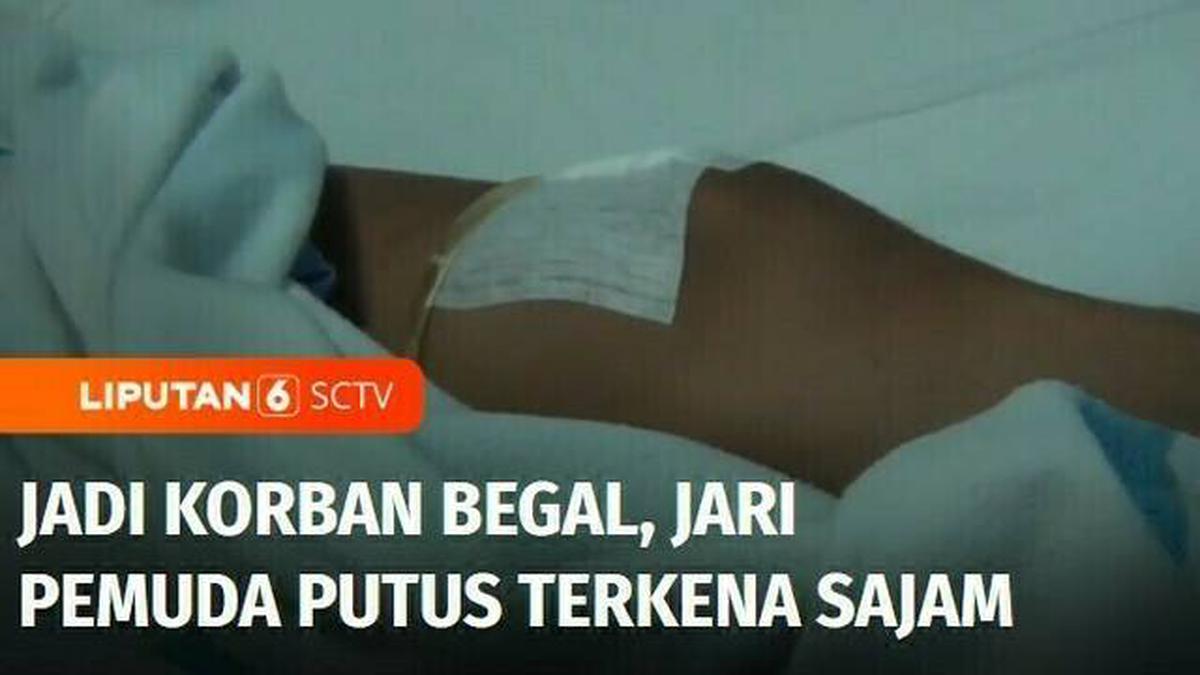 VIDEO: Jadi Korban Begal Motor, Jari Pemuda Putus Terkena Senjata Tajam ...
