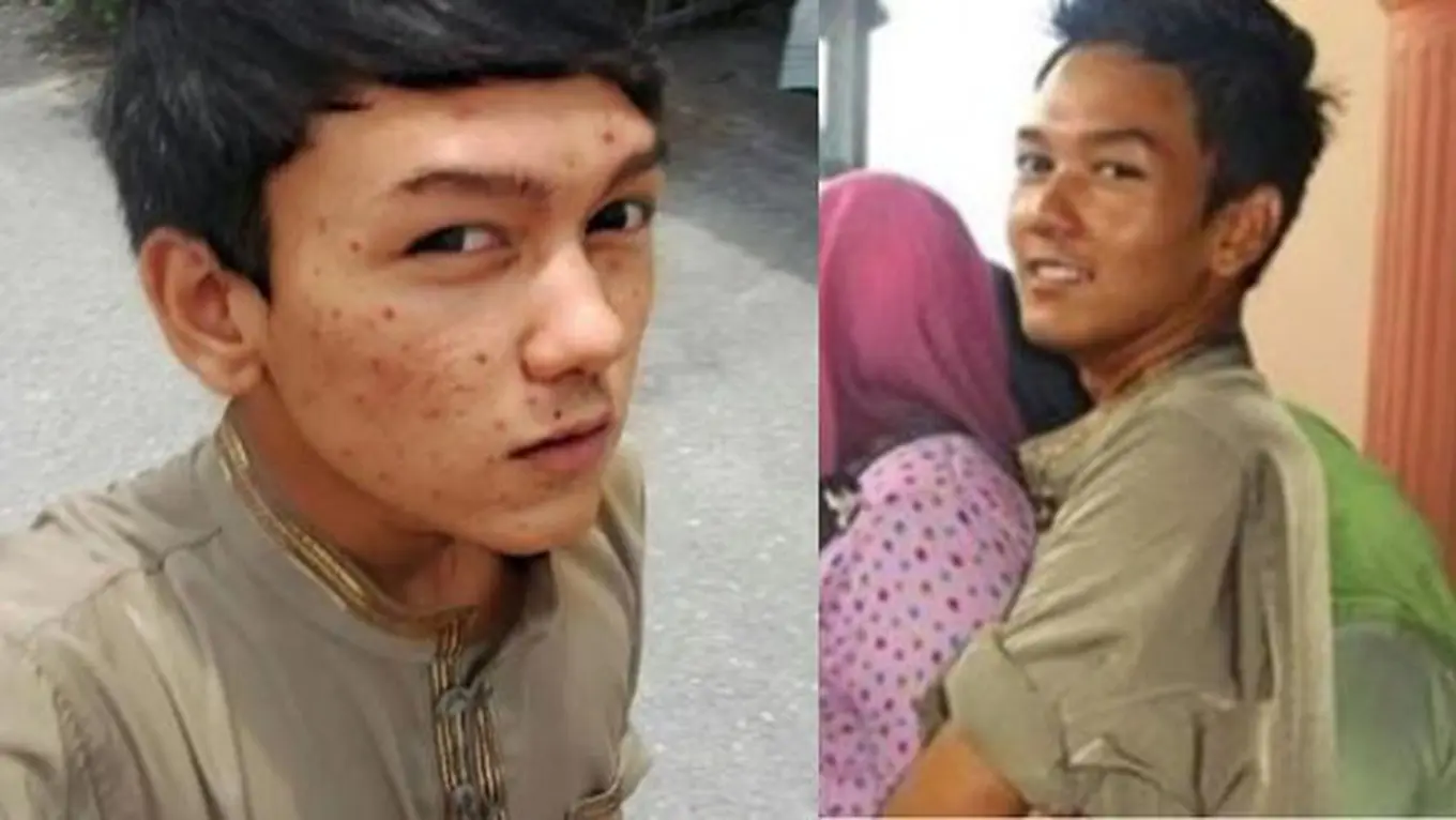 Oplas Agar Mirip Karakter Anime, Pemuda Ini Tuai Kritikan Netizen