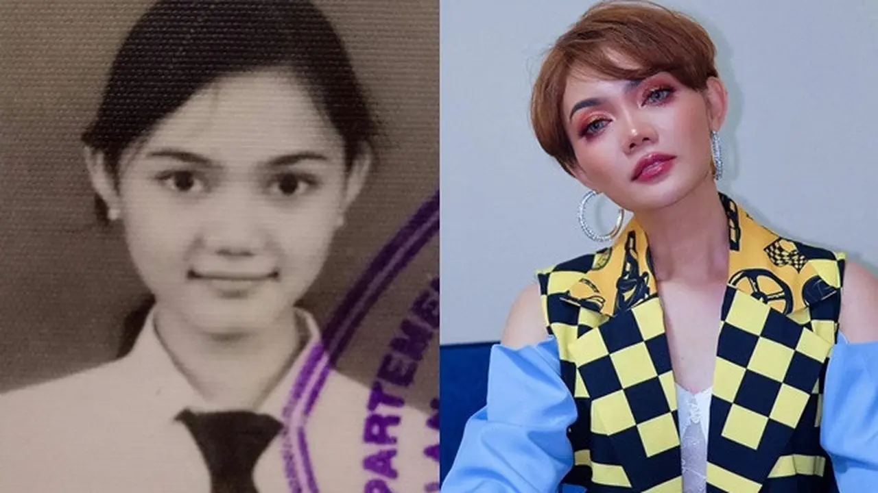 6 Potret Transformasi Rina Nose dari Remaja hingga Kini, Berhijab Bikin Pangling - Hot Liputan6.com