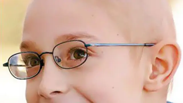 Anak Lelaki yang Tiba-tiba Alami Kebotakan Bisa Frustasi - Health ...