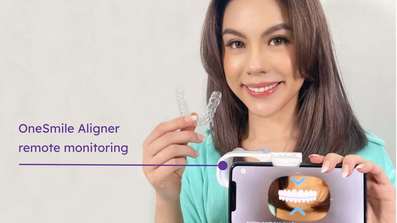 Pengguna Aligner Gigi di Indonesia Kini Makin Dimanjakan dengan Pelayanan OneSmile - ShowBiz ...