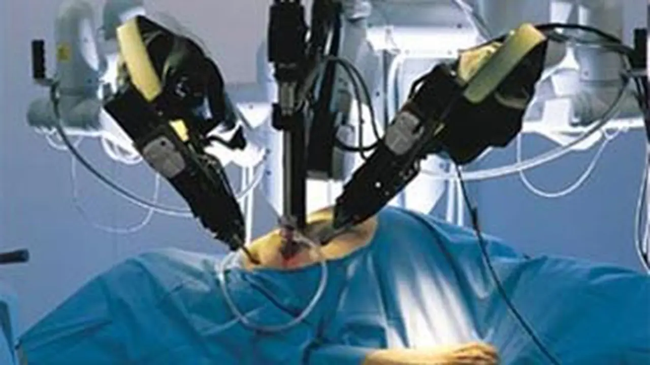 Robotic Surgery Tetap Mengandalkan Keahlian si Dokter Bedah - Health ...