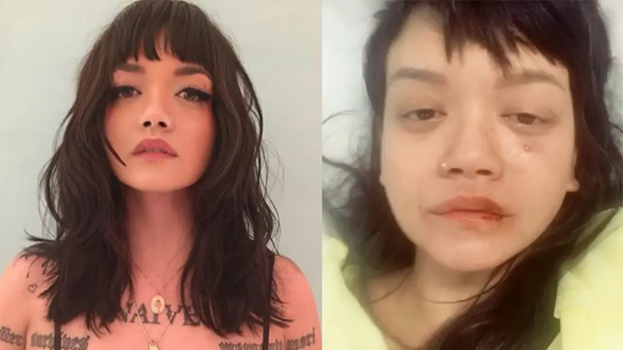 Dylan Sada, Model Nyentrik Indonesia Curhat Alami Kekerasan dari ...