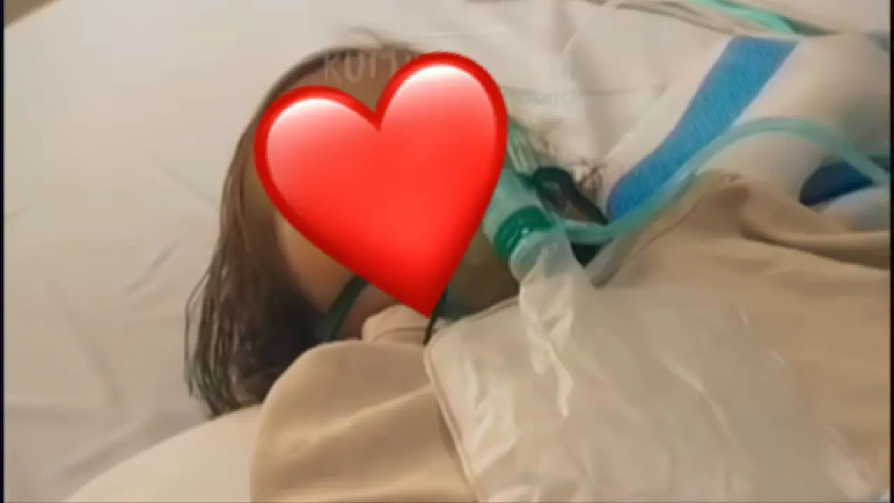 5 Respons Dokter, Gubernur KDM hingga Kemenkes Terkait Raya Bocah Sukabumi Meninggal Tubuh Penuh ...