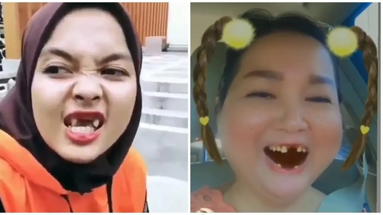 6 Kelakuan Kocak Orang Gigi Ompong Ini Bikin Susah Tahan Ketawa - Hot ...