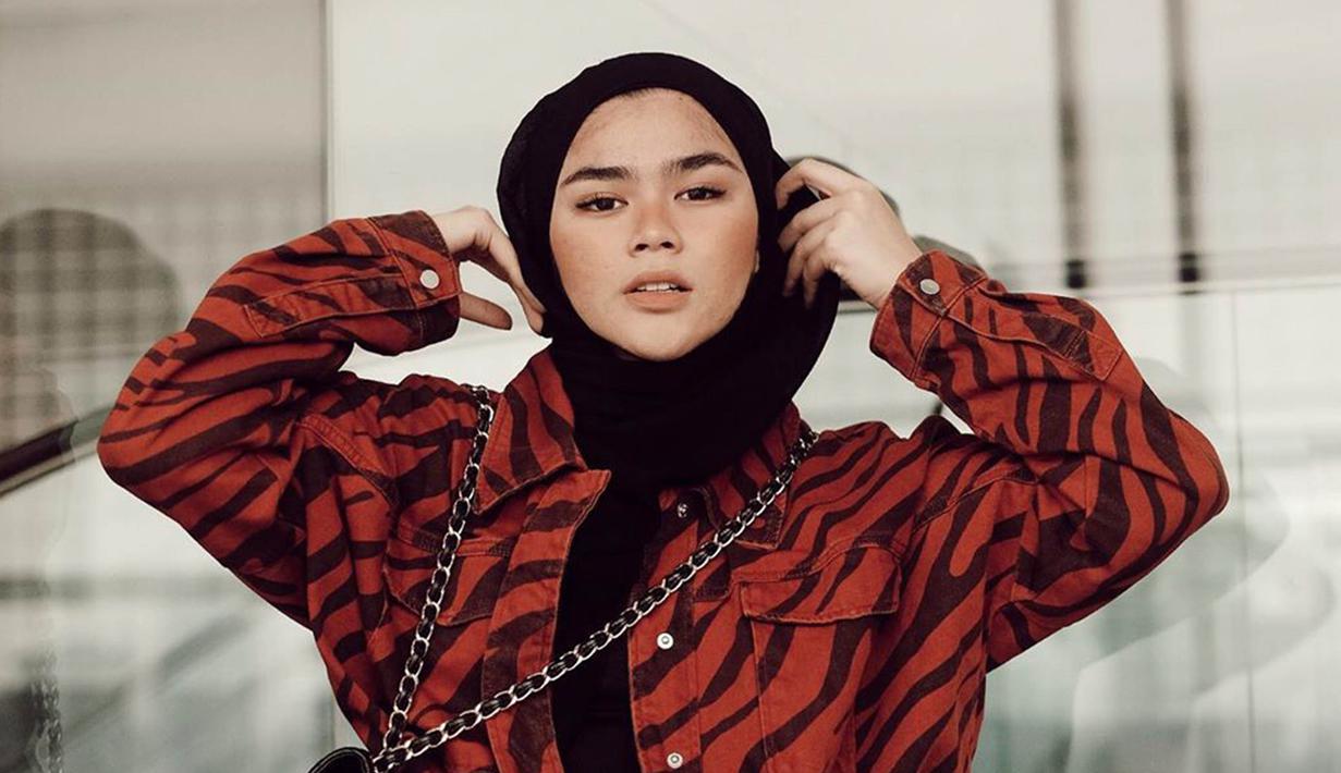 FOTO: 4 Potret Sivia Eks Blink yang Jadi Penyanyi Solo - Foto Liputan6.com