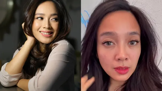 5 Potret Terbaru Dea Ananda Percaya Diri Pamer Uban, Tampil Awet Muda Usia 38 - ShowBiz Liputan6.com