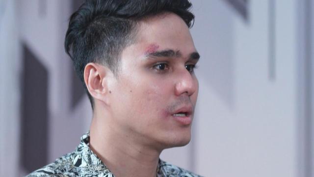 Sinopsis Sinetron SCTV Samudra Cinta: Cinta Panik Tak Bisa Gerakkan ...