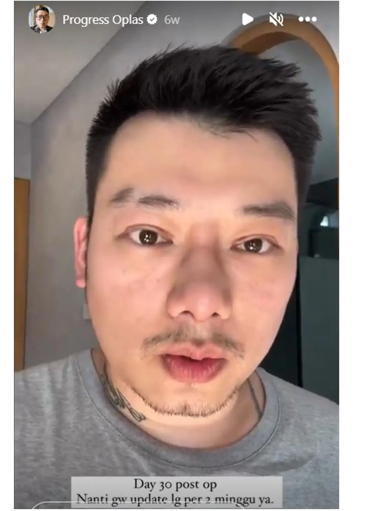 7 Potret Chef William Gozali Jalani Operasi Plastik, Perubahannya Bikin Pangling - Hot Liputan6.com