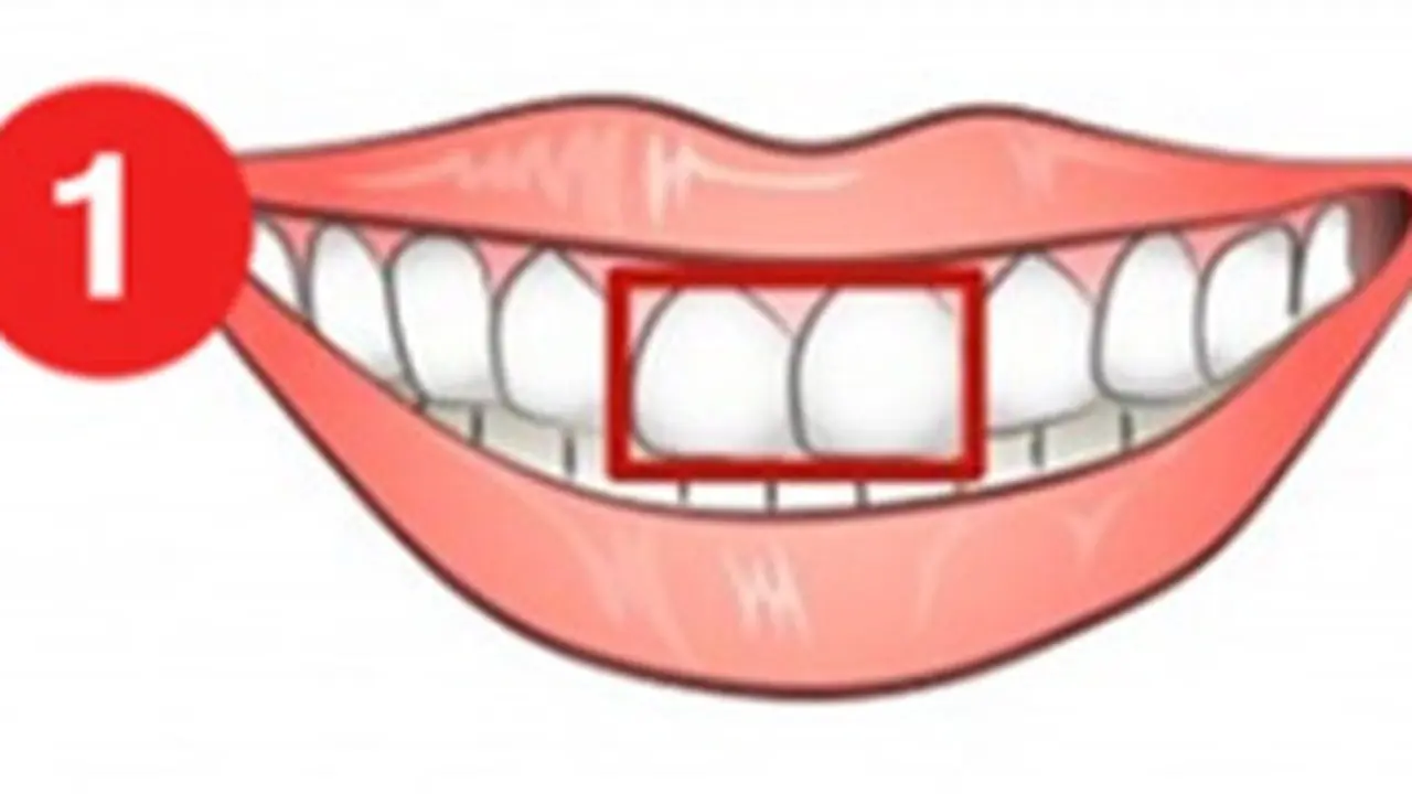 Bentuk Gigi Ternyata Bisa Ungkap Kepribadian, 1 Sampai 4 Kamu Nomor ...