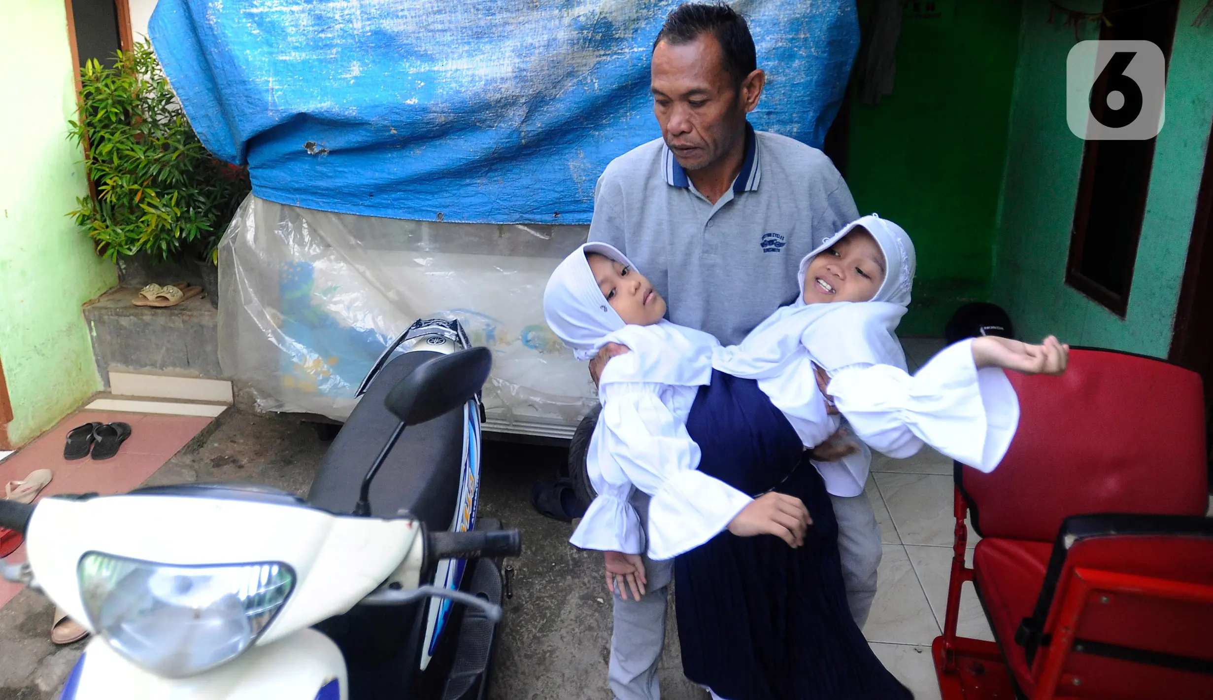 Potret Semangat Kembar Siam Al Dewi dan Al Putri Asal Garut - Foto ...