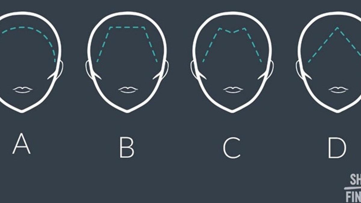 Garis Batas Rambut Kamu Bentuknya Kayak Gimana? Yuk, Ketahui Artinya ...