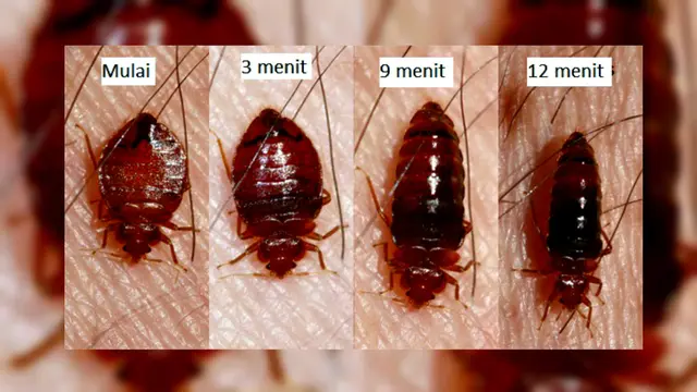 6 Fakta Kutu Busuk Serang Fasilitas Umum di Paris, Masyarakat: Kami Panik! - Hot Liputan6.com