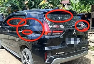 6 Fakta Penting tentang Virus Campak pada Anak yang Wajib Diketahui ...