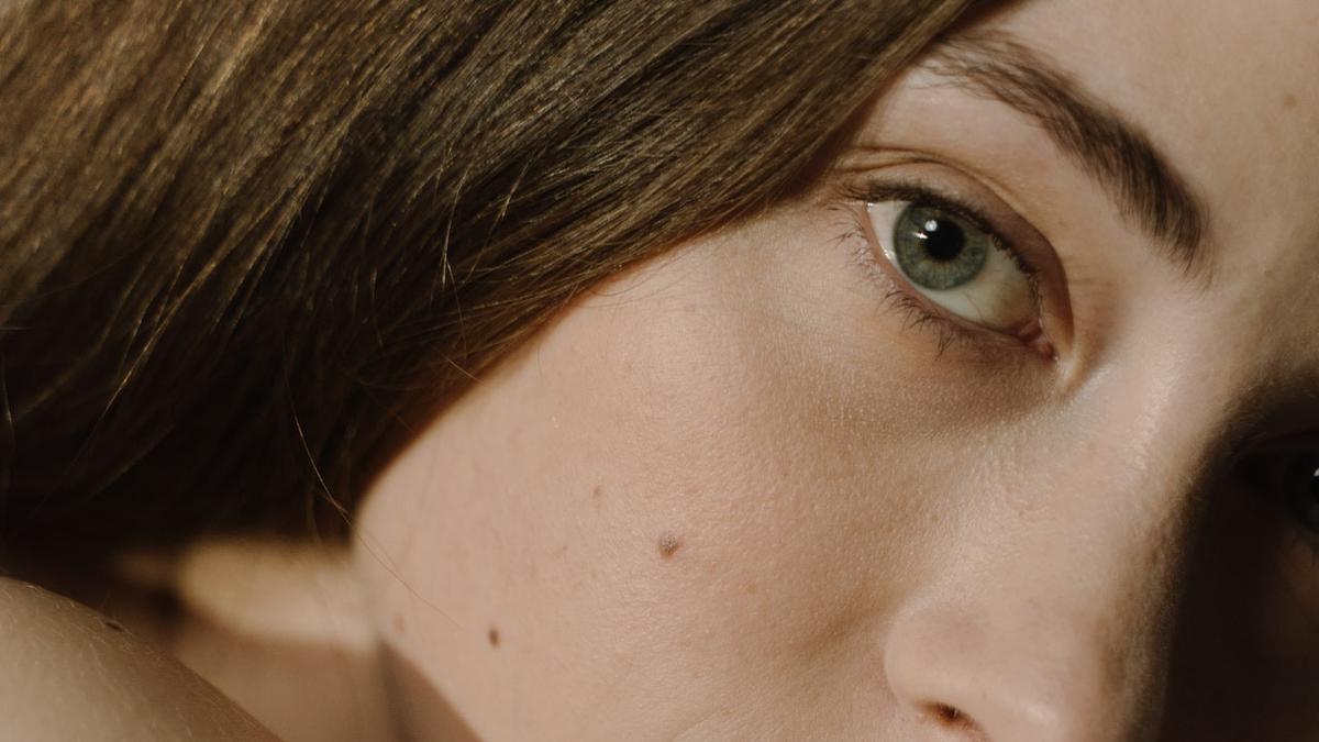 7 Arti Tahi Lalat di Bagian Tubuh, Ungkap Karakter dan Keberuntungan Kamu - Info Fimela.com