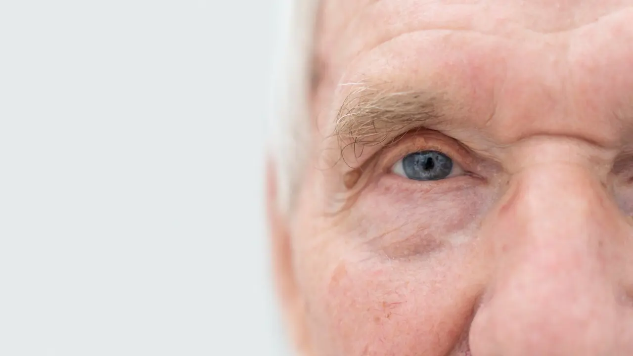 Hari Glaukoma Sedunia 12 Maret, Kenali Gejala dan Pencegahannya ...