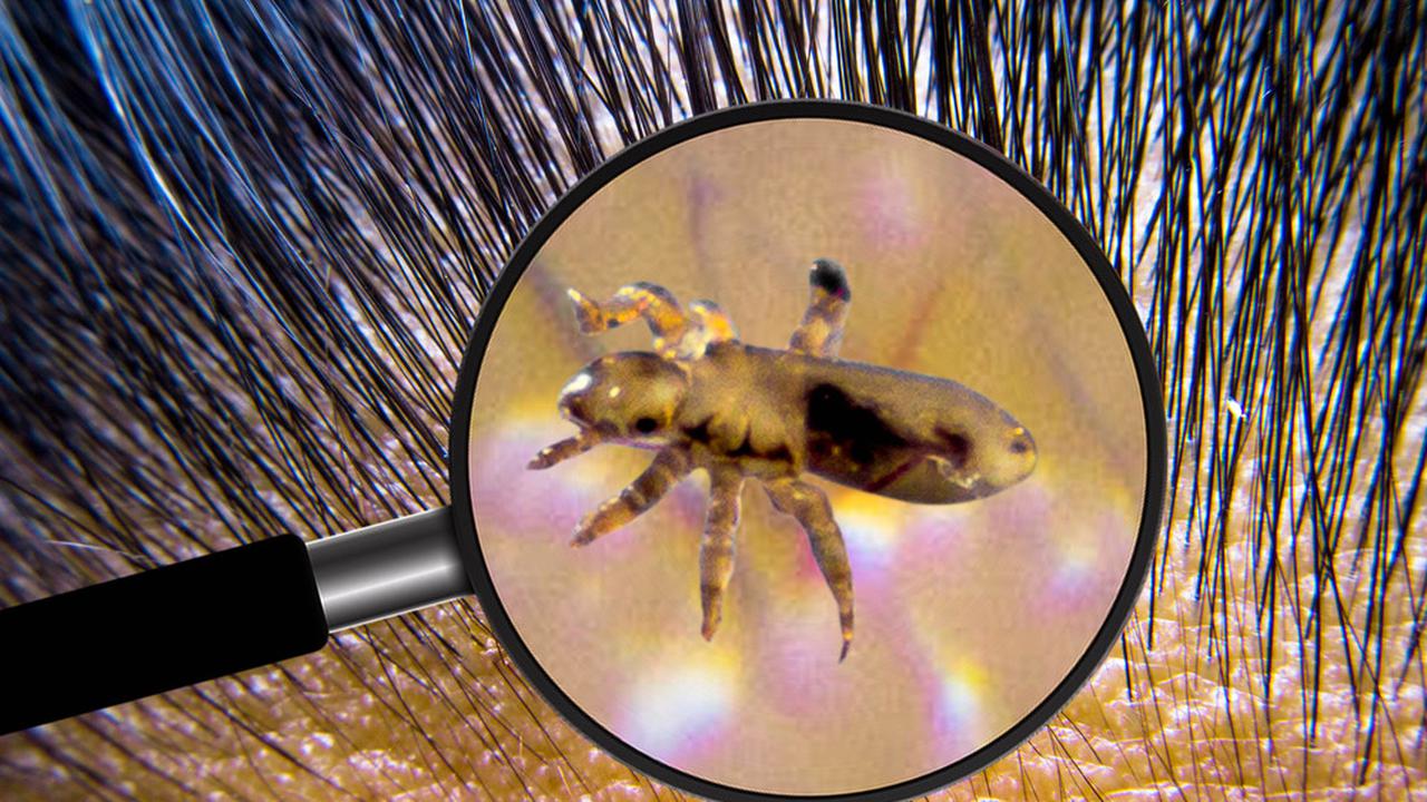 13 Contoh Simbiosis Parasitisme, Ketahui Pengertian dan Jenisnya