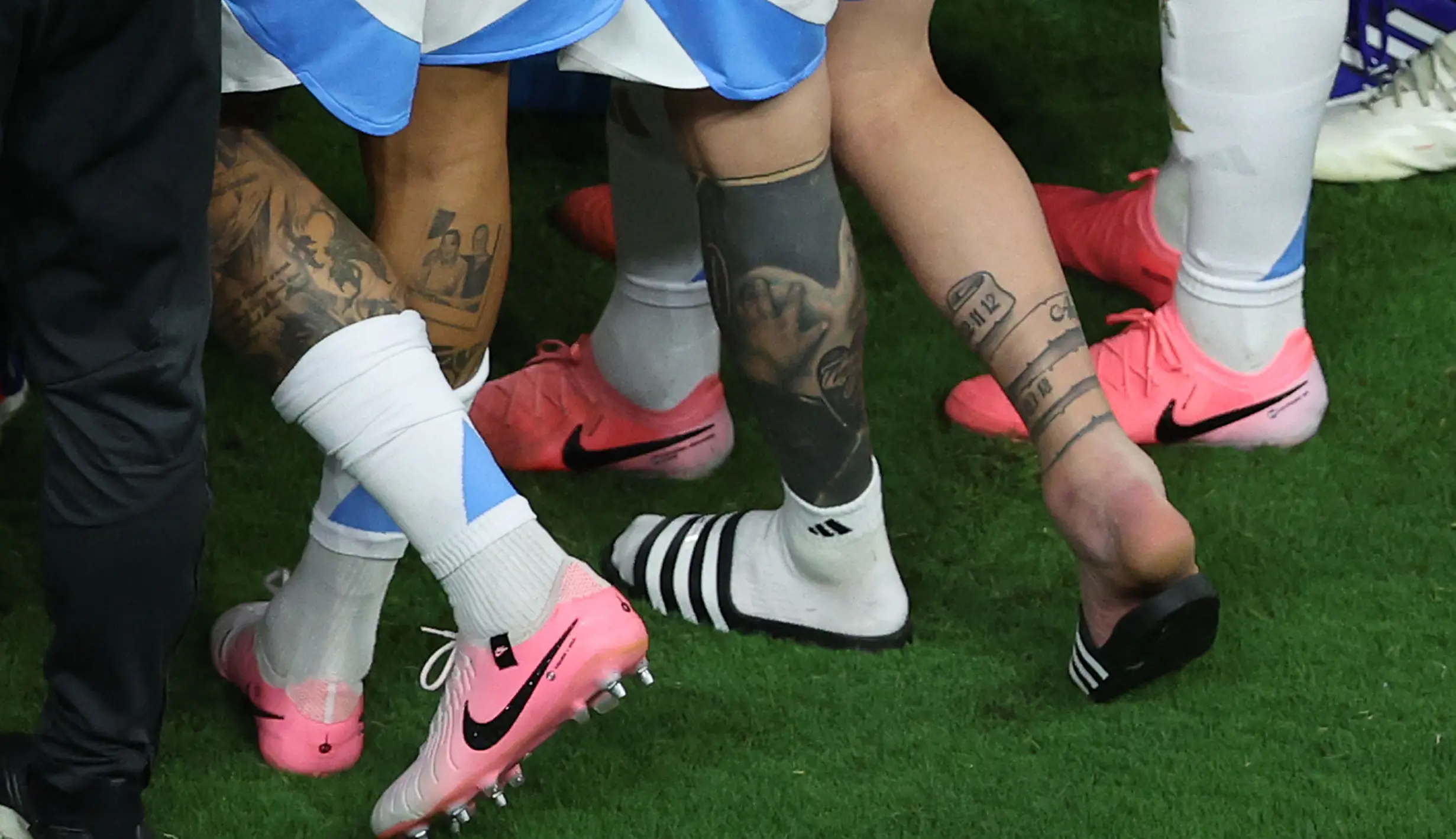 Foto: Penampakan Kaki Bengkak Lionel Messi di Final Copa America 2024 ...