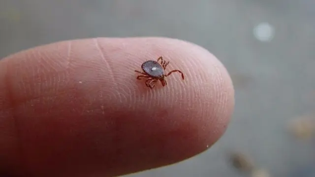 Digigit Kutu, Gadis Cilik Ini Mendadak Lumpuh - Health Liputan6.com