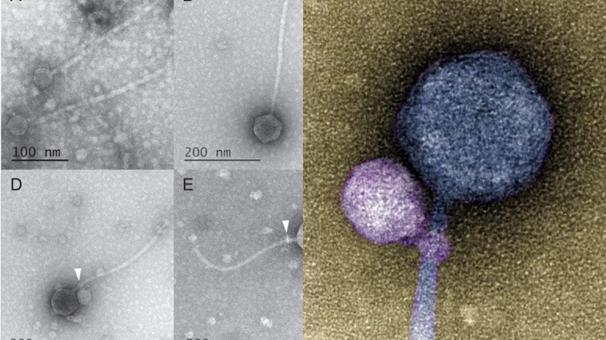 Bukan Inang, Ilmuwan Ungkap Pertama Kalinya Virus Menempel di Virus ...