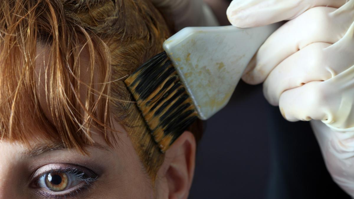 Wajah Kakak Beradik Bengkak Setelah Cat Rambut - Health Liputan6.com