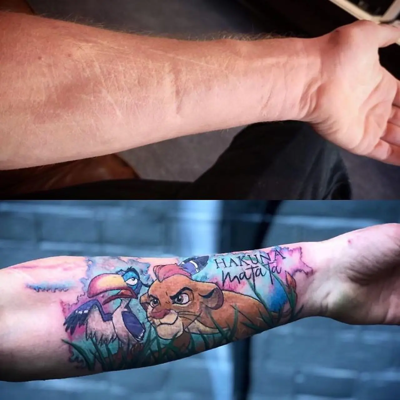 Kreatif Banget, 10 Kreasi Ubah Bekas Luka Jadi Tato Keren - Citizen6 ...