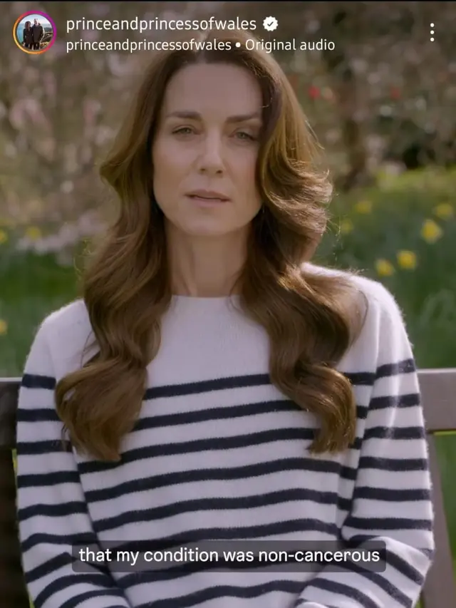 Kate Middleton Umumkan Dirinya Sakit Kanker, Kini Mulai Jalani ...