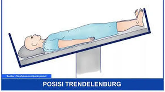 Mengenal Posisi Trendelenburg, Manfaat, dan Langkahnya dalam Dunia ...