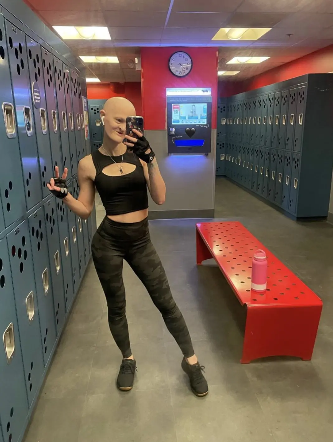 6 Potret Melanie Gaydos, Model Sukses yang Idap Kelainan Genetik ...