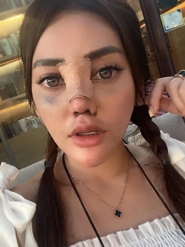 6 Potret Daniar MasterChef Usai Operasi Hidung, Jadi Sorotan - Hot Liputan6.com