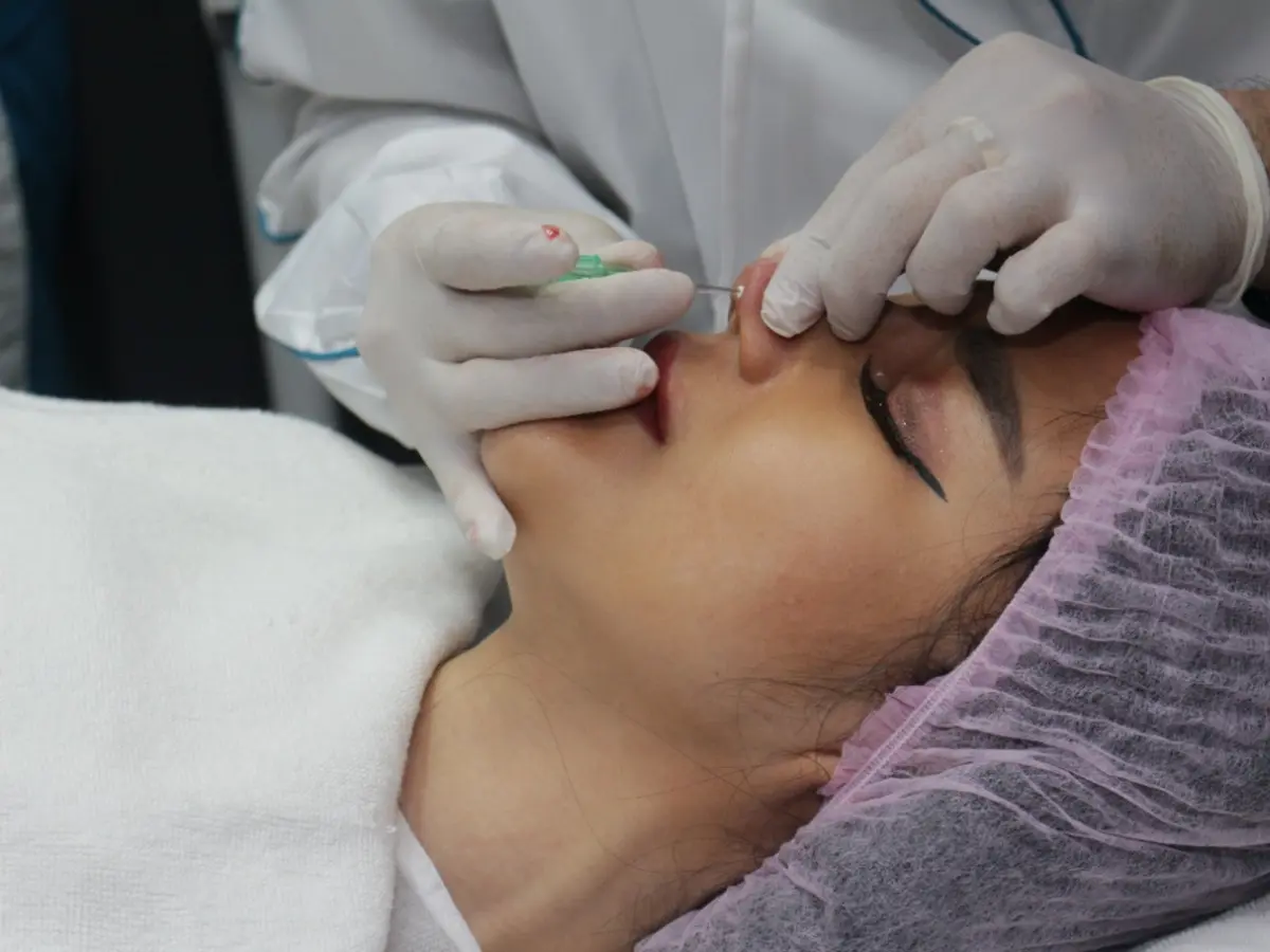 Tips Tanam Benang Hidung yang Wajib Anda Ketahui! - Coterie Clinic