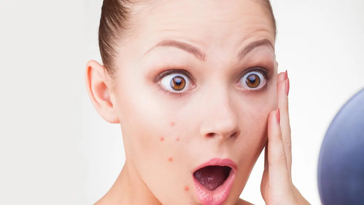 Cara Mengobati Bisul dengan Alami Serta Pencegahannya - Hot Liputan6.com