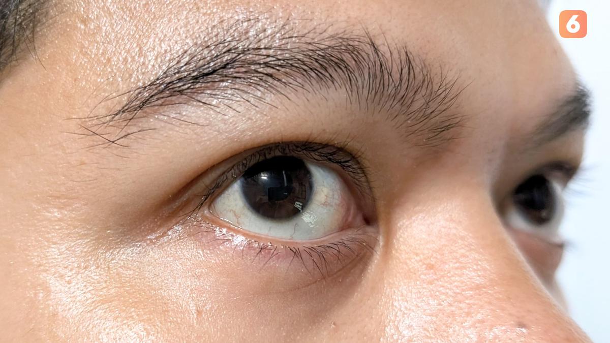 Mengenal Mata Silinder alias Astigmatisme: Penyebab, Gejala, hingga ...