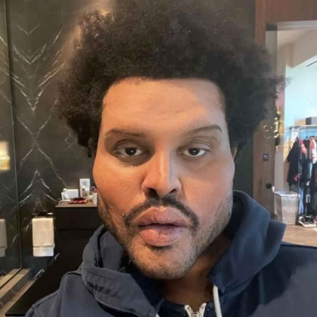 Penampilan Baru The Weeknd Aneh dan Bikin Kaget, Diduga Jalani Operasi ...