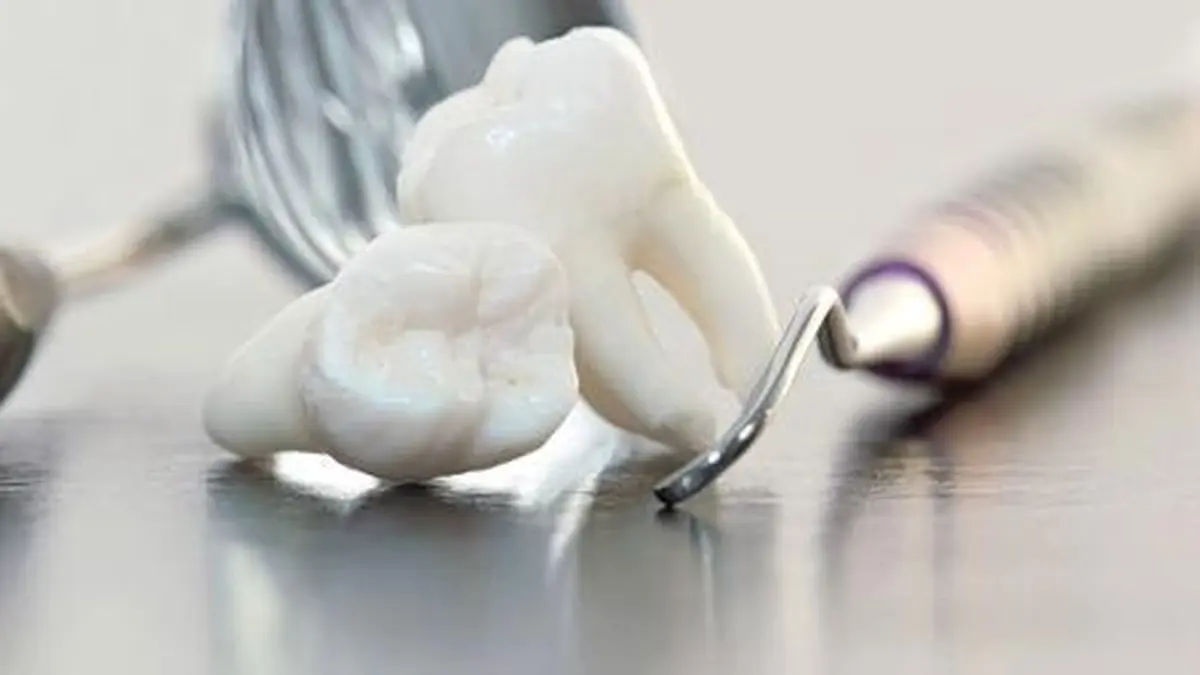 Berita cabut gigi viral Hari Ini - Kabar Terbaru Terkini | Liputan6.com