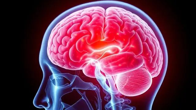 Brain Bypass Surgery STA-MCA, Harapan Baru untuk Cegah Stroke Berulang ...