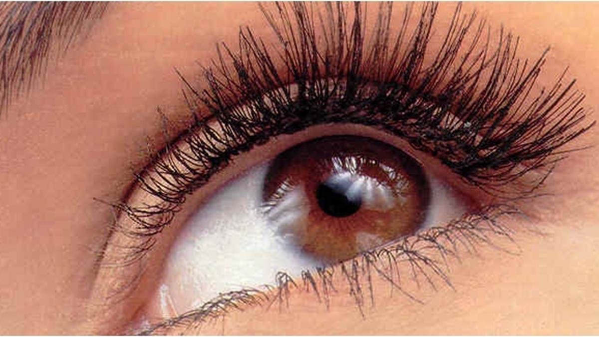 Kenali Jenis Operasi Mata - Bagian 2 - Beauty Fimela.com