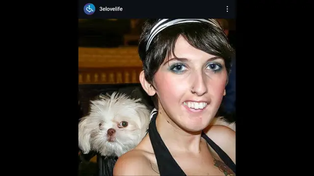 Annie Hopkins, Sosok Penyandang Disabilitas di Balik Hari Penerimaan ...