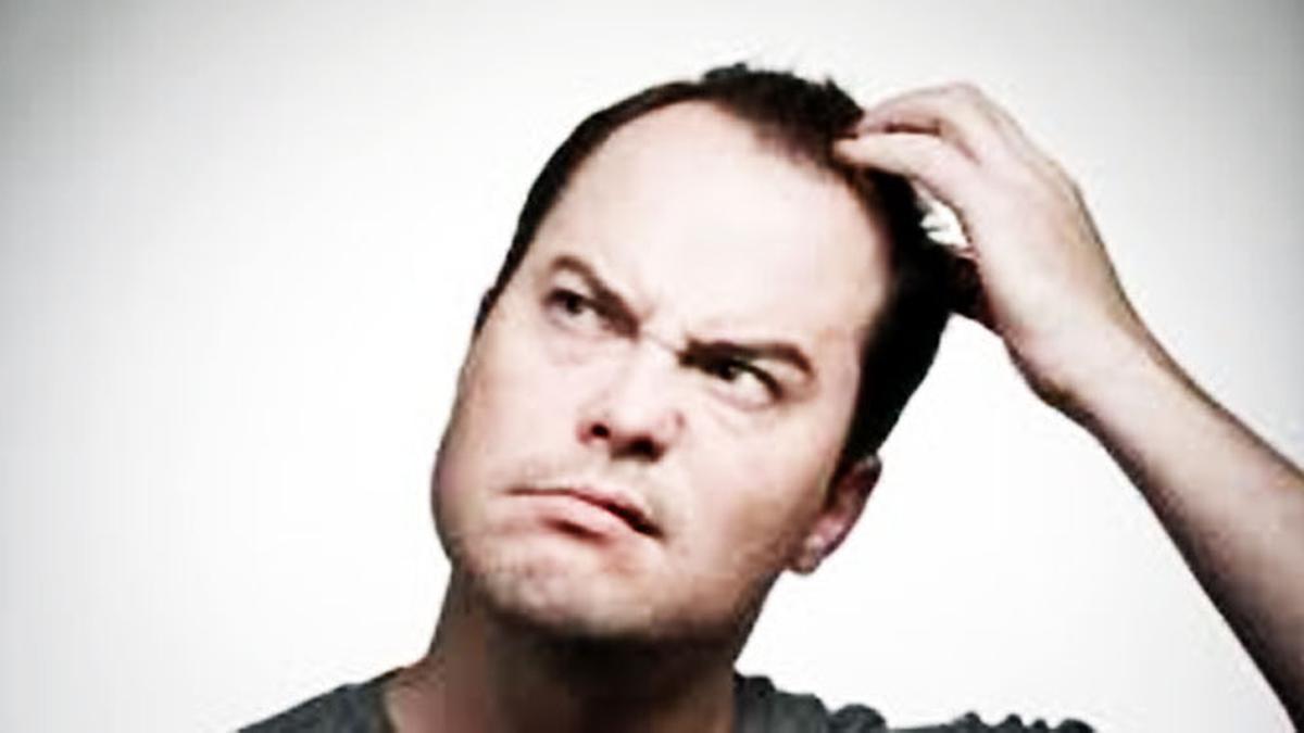 Pikun Bisa Terjadi Sejak Usia 30 Tahun - Health Liputan6.com