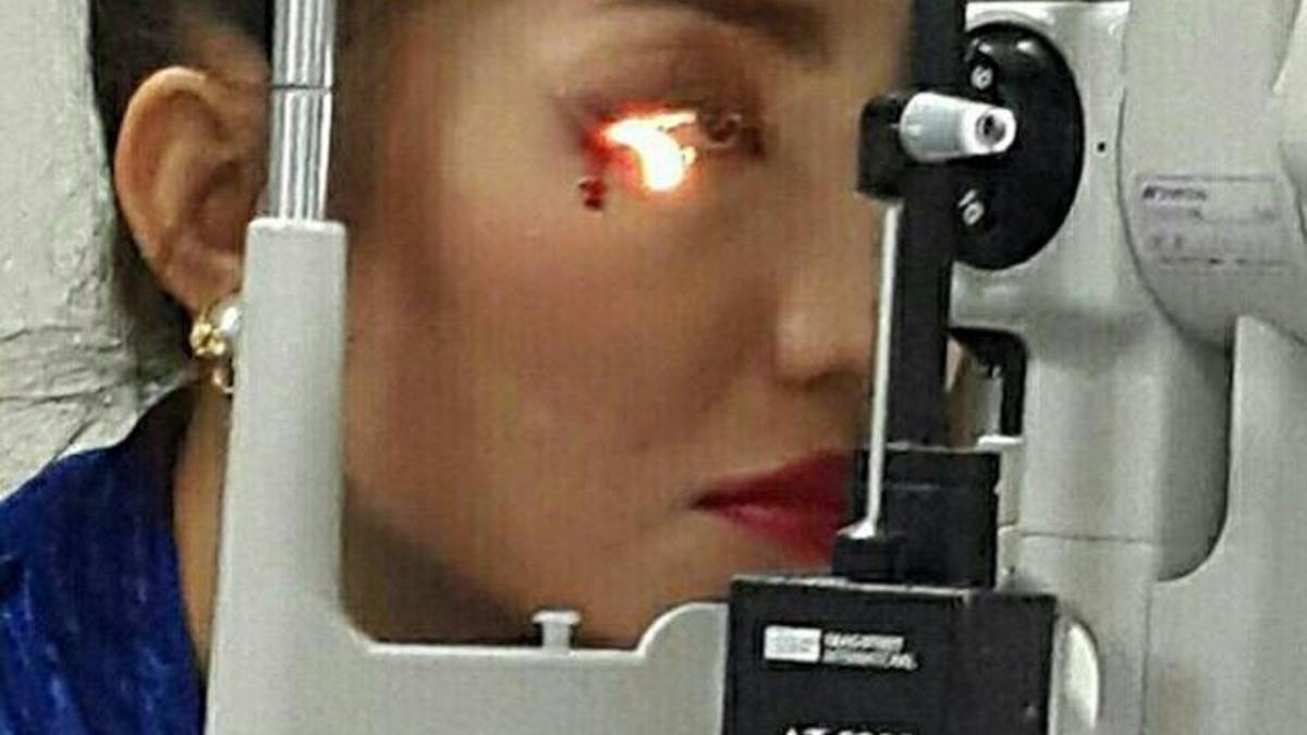 Mata Lebam dan Berdarah, Ayu Dewi: Ada Pelangi di Mataku ...