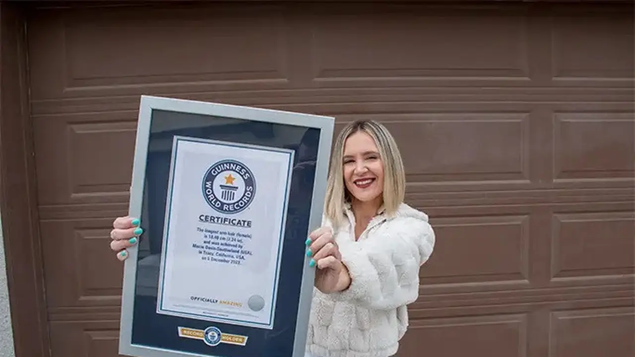 Wanita Ini Punya Bulu di Tangan Sepanjang 18 cm, Cetak Rekor Dunia ...