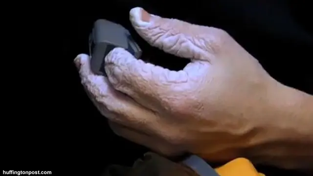 10 Hari, Tim Yarrow Menyelam di Air Hingga Keriput - Health Liputan6.com