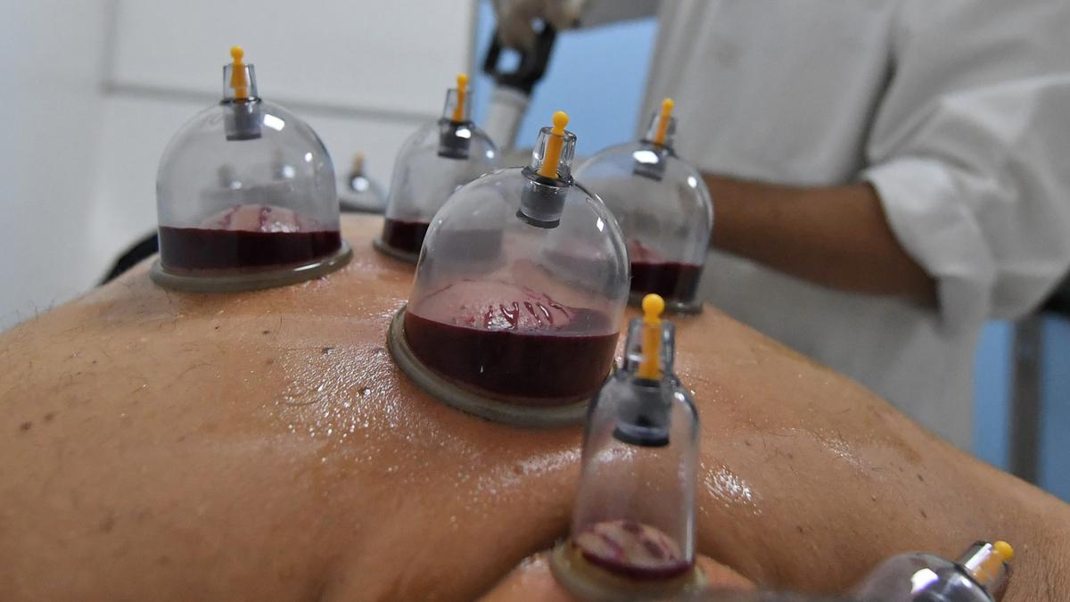 Punya Manfaat, Dokter Ungkap Cara Jadikan Bekam sebagai Layanan ...